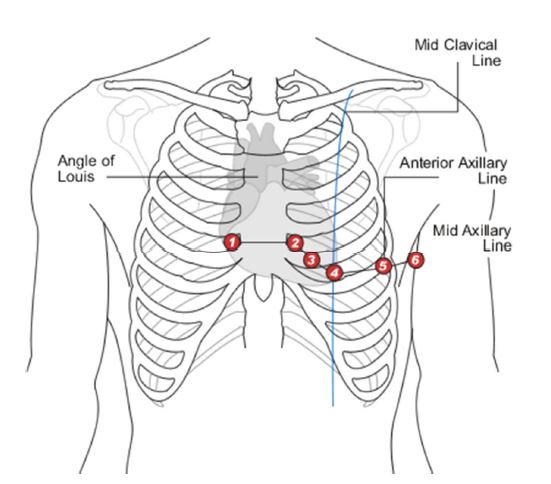 Electrocardiograms and You | NorthWest Cardio Diagnostics